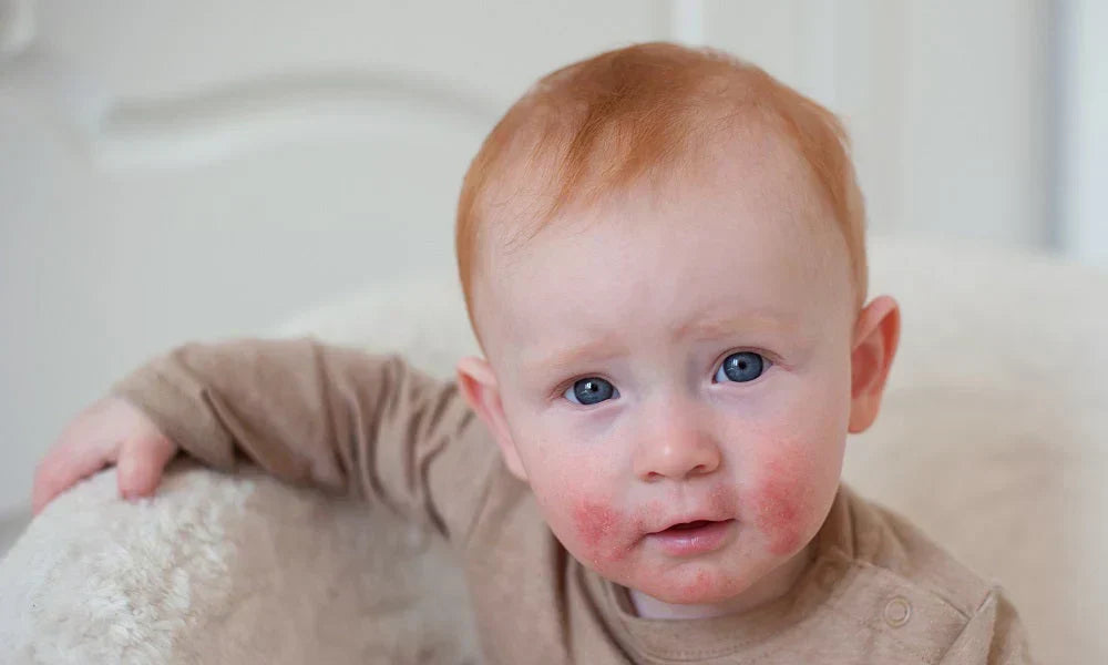 Baby Drool Rash: 5 Habits to Avoid + Approved Care – Aiwibi Malaysia